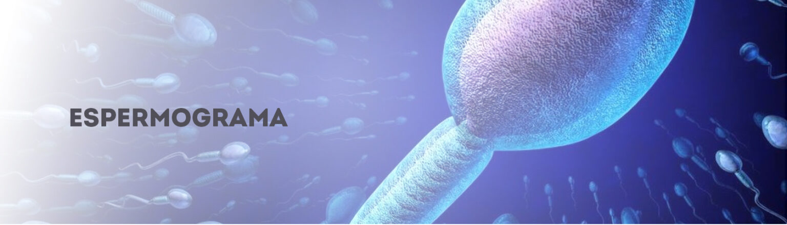 Espermograma – Fertway